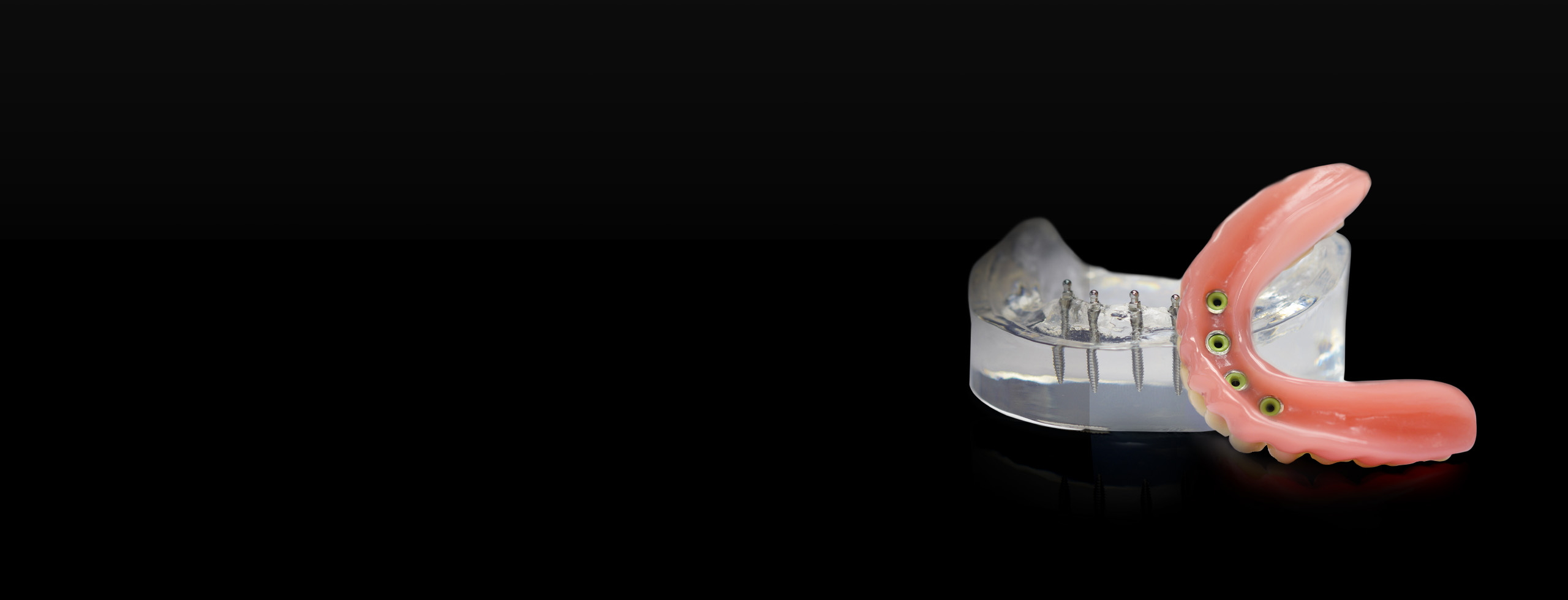 prothese auf mini implantate-dgdoa besucher | permadental