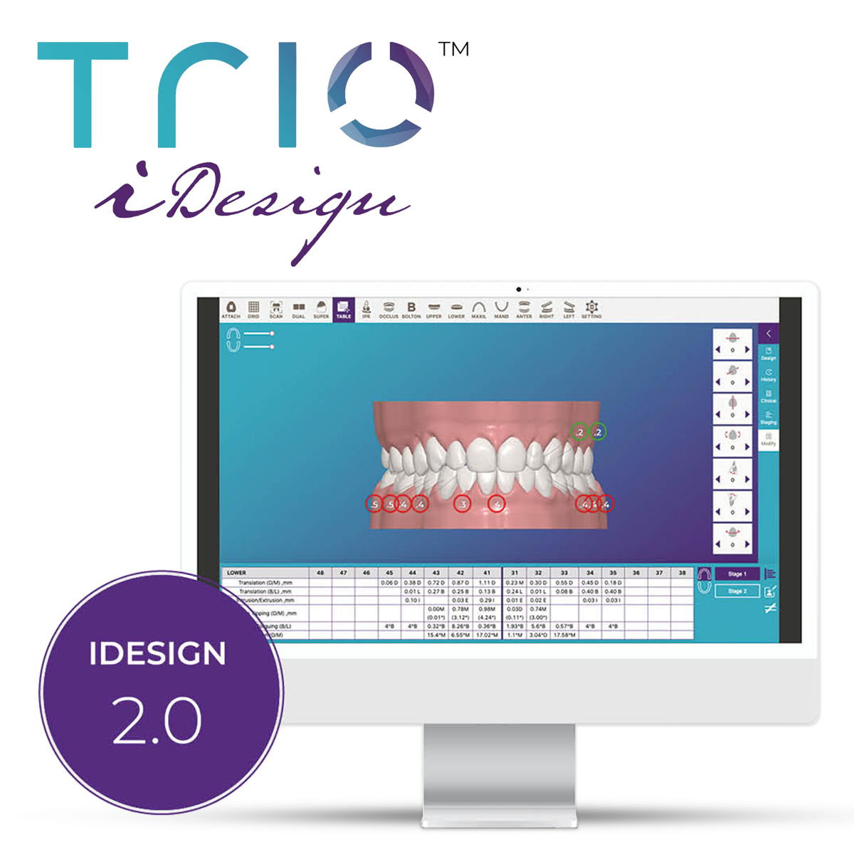 TrioClear Aligner | permadental